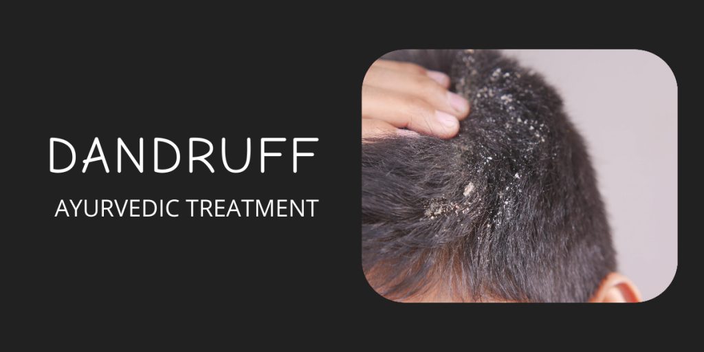 Dandruff Treatment In Ayurveda